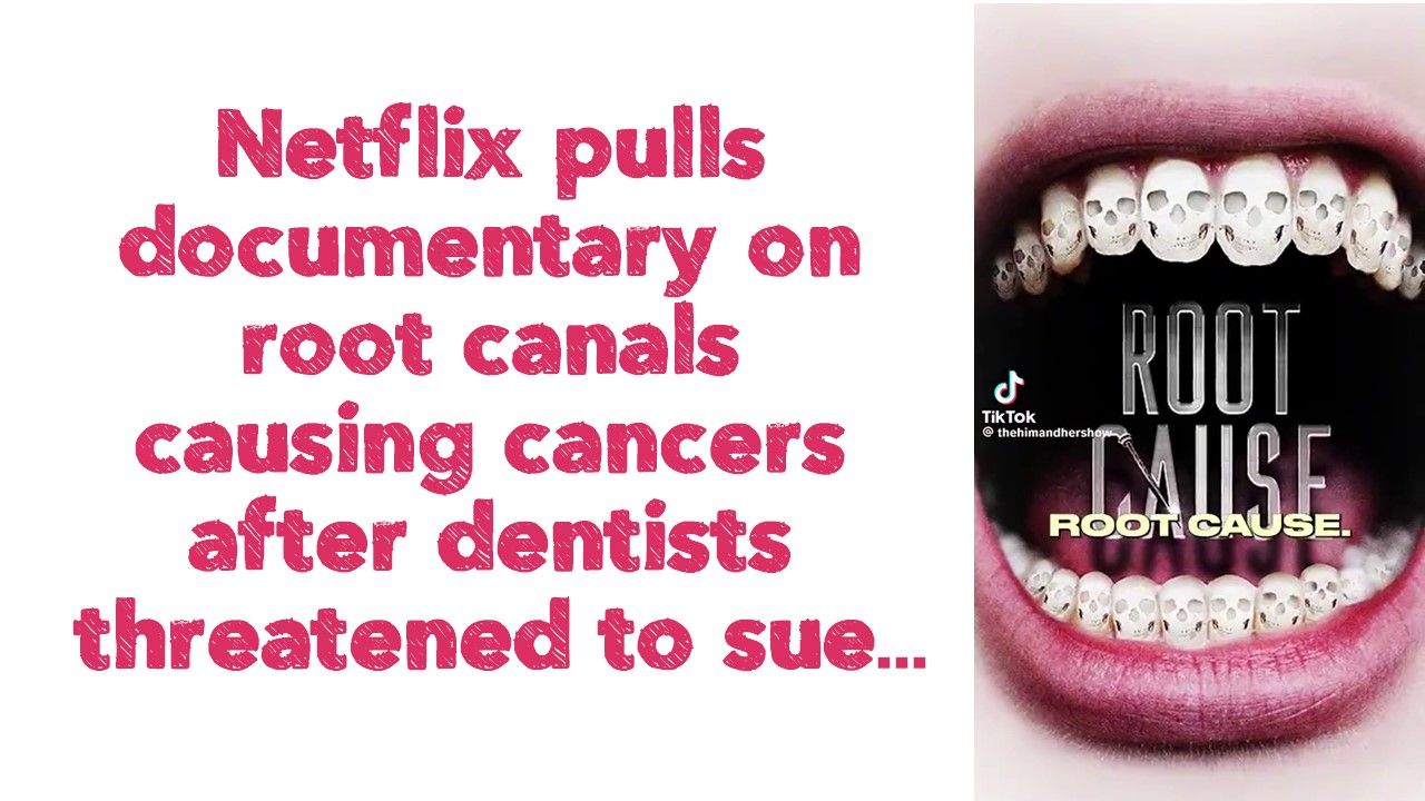 Netflix pulls documentary on root canals causing cancers after dentists threatened to sue ...