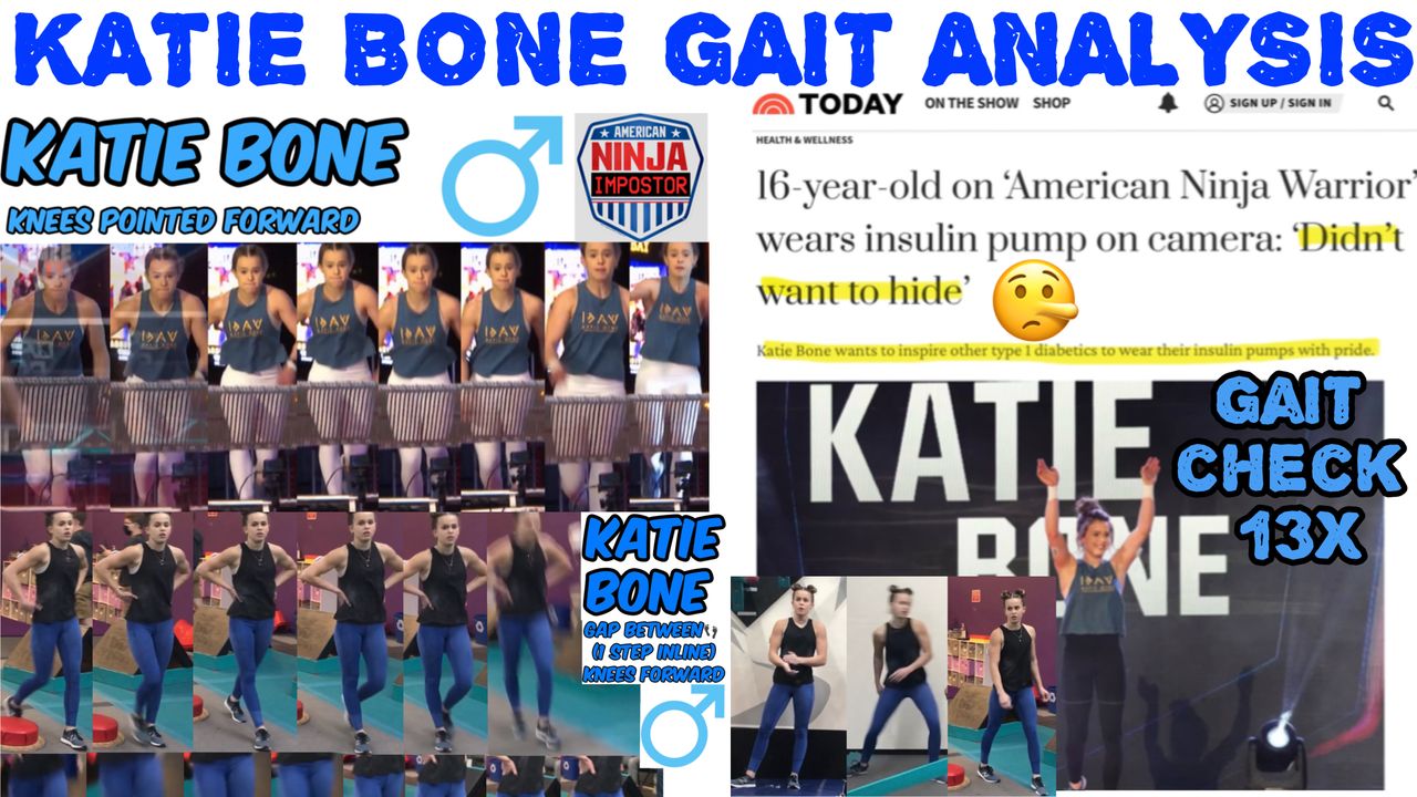 KATIE BONE GAIT ANALYSIS - Brighteon .com