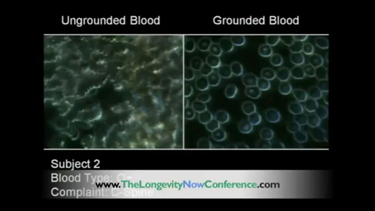 GROUNDING BLOOD / UN-CLUMPING AFTER 45MIN OF BEING GROUNDED - Brighteon.com