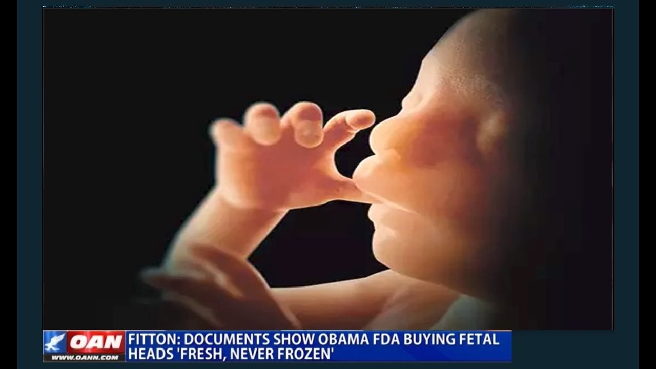 Tom Fitton Judicial Watch: Obama's FDA Purchased 'Fresh' Aborted Baby ...