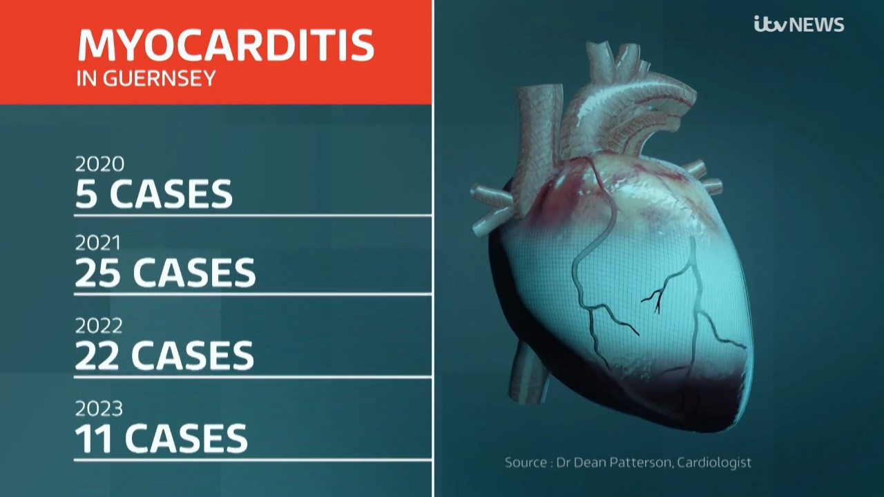 Guernsey cardiologist Dr Patterson calls for investigation into Covid ...